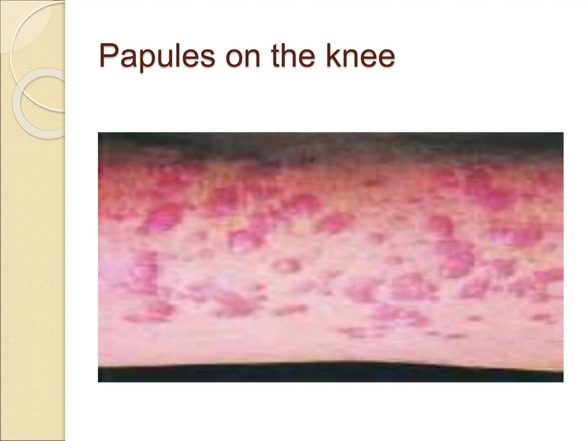3.5 Skin and integumentary Assessment.ppt