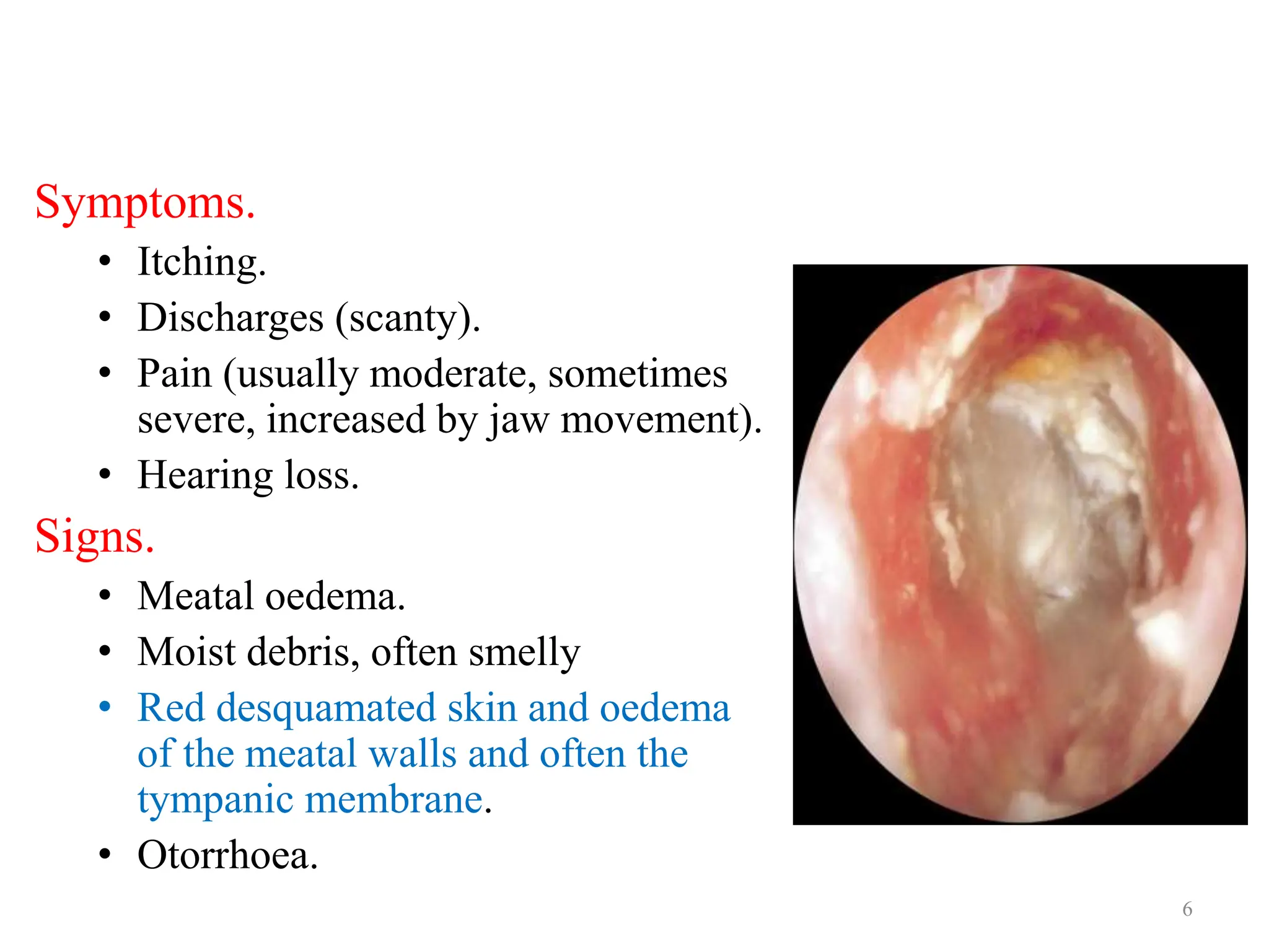 Otitis externa on human ear Pathophysiology | PPTX