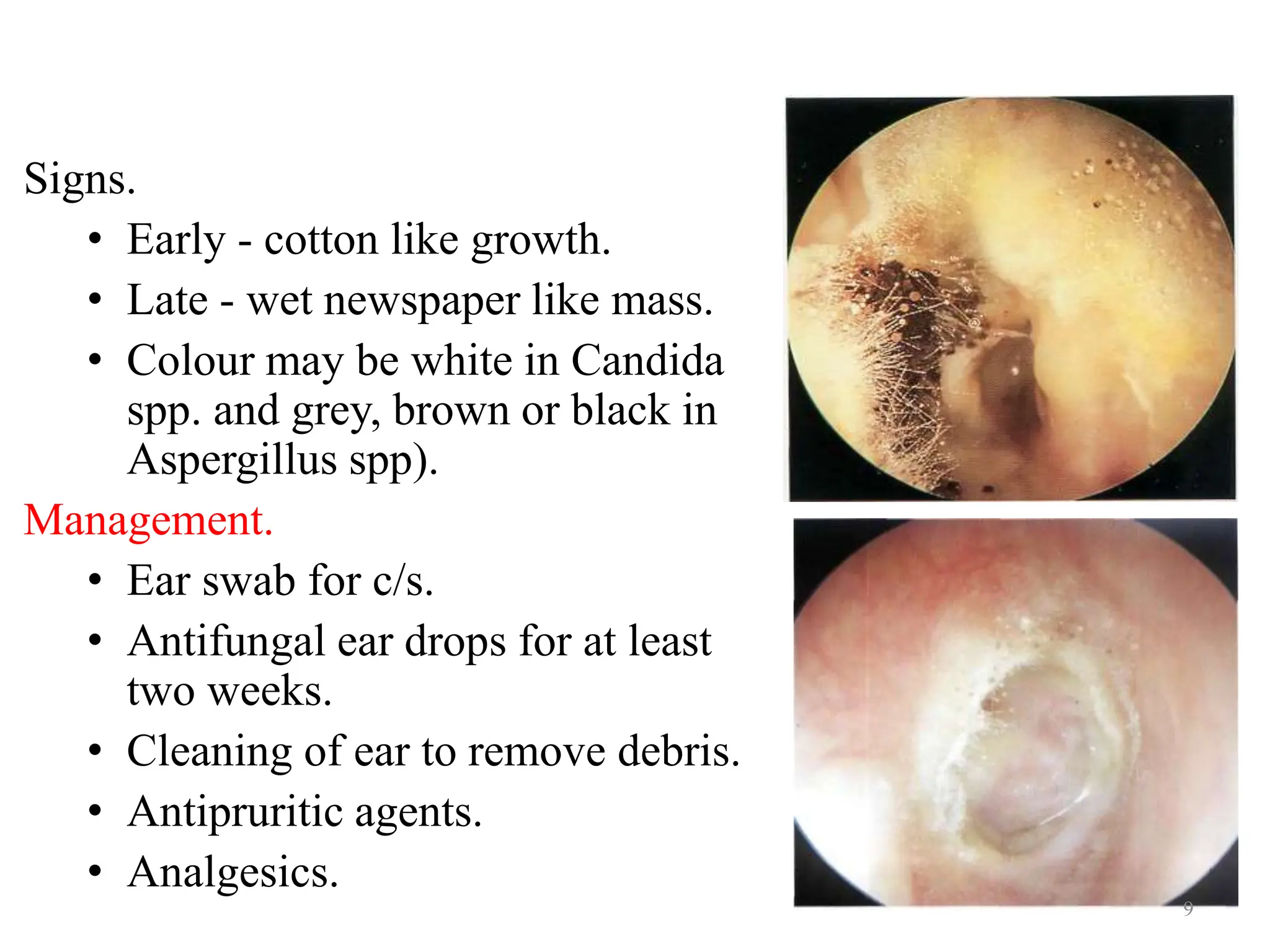 Otitis externa on human ear Pathophysiology | PPTX