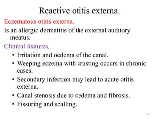 Otitis externa on human ear Pathophysiology | PPTX