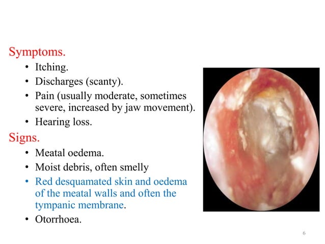 Otitis externa on human ear Pathophysiology | PPTX | Ear, Nose and ...