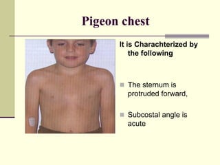 3. Chest examination.ppt ehbeiebeiwbbwbsiehbe | PPT