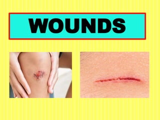 3. SEMESTER IV UNIT II NOTES FOR TYPES OF WOUNDS.pptx