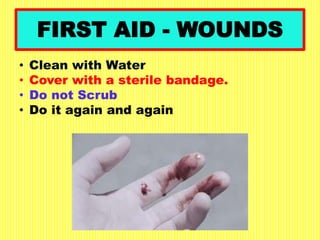 3. SEMESTER IV UNIT II NOTES FOR TYPES OF WOUNDS.pptx