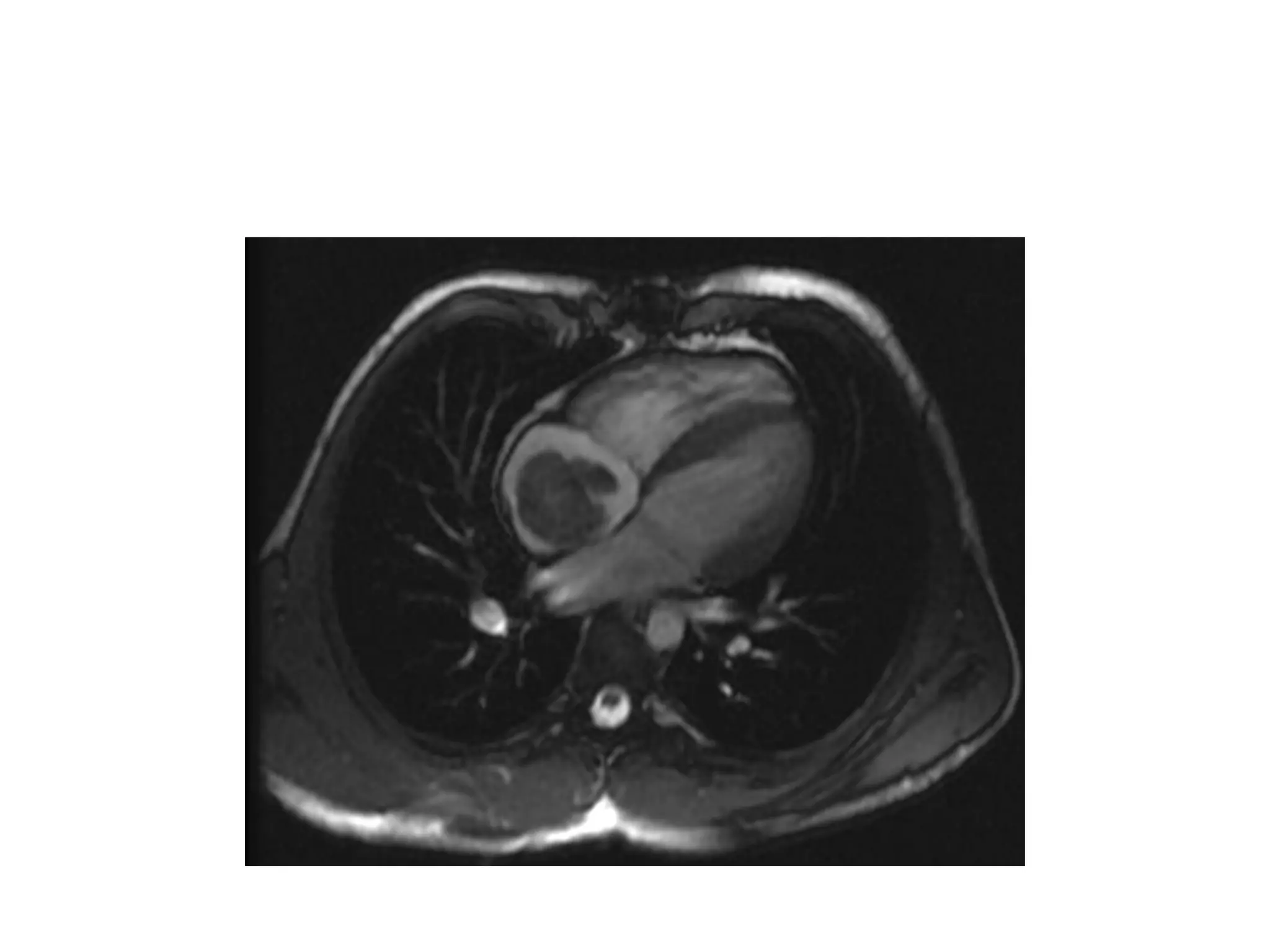 3.4 Cardiac MRI and CT in cardiology for evaluation | PDF
