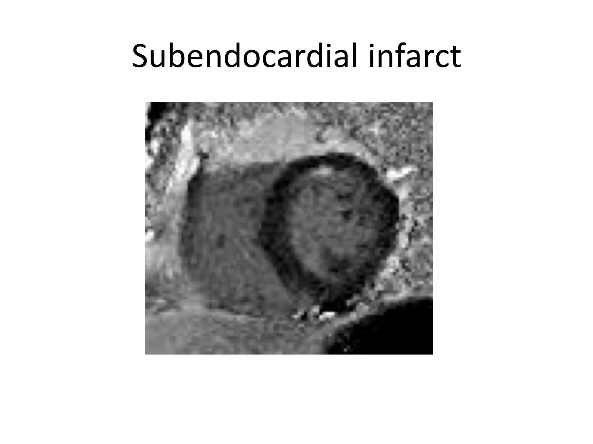 3.4 Cardiac MRI and CT in cardiology for evaluation | PDF