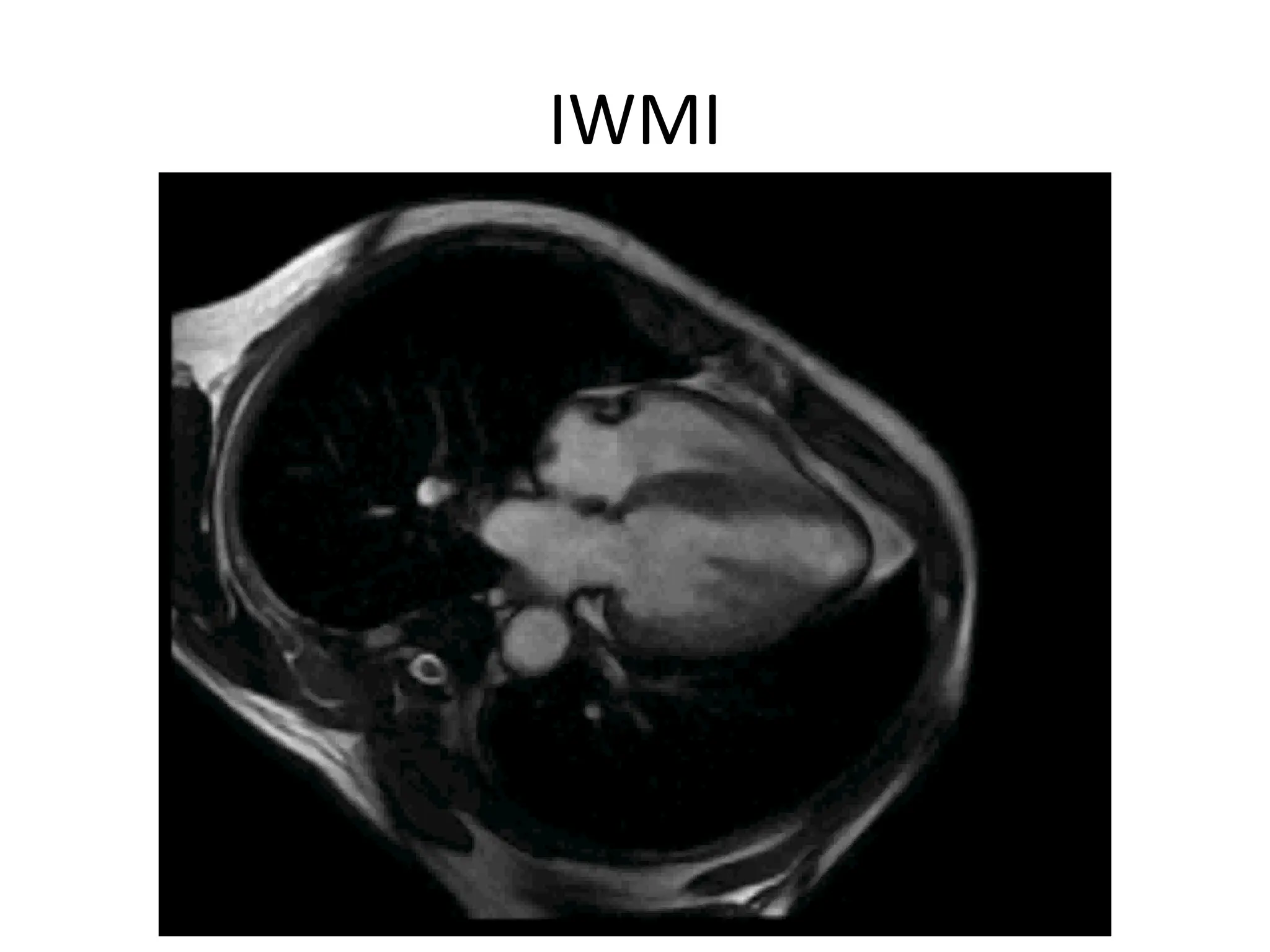 3.4 Cardiac MRI and CT in cardiology for evaluation | PDF
