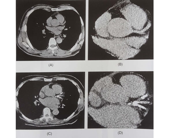 3.4 Cardiac MRI and CT in cardiology for evaluation | PPT