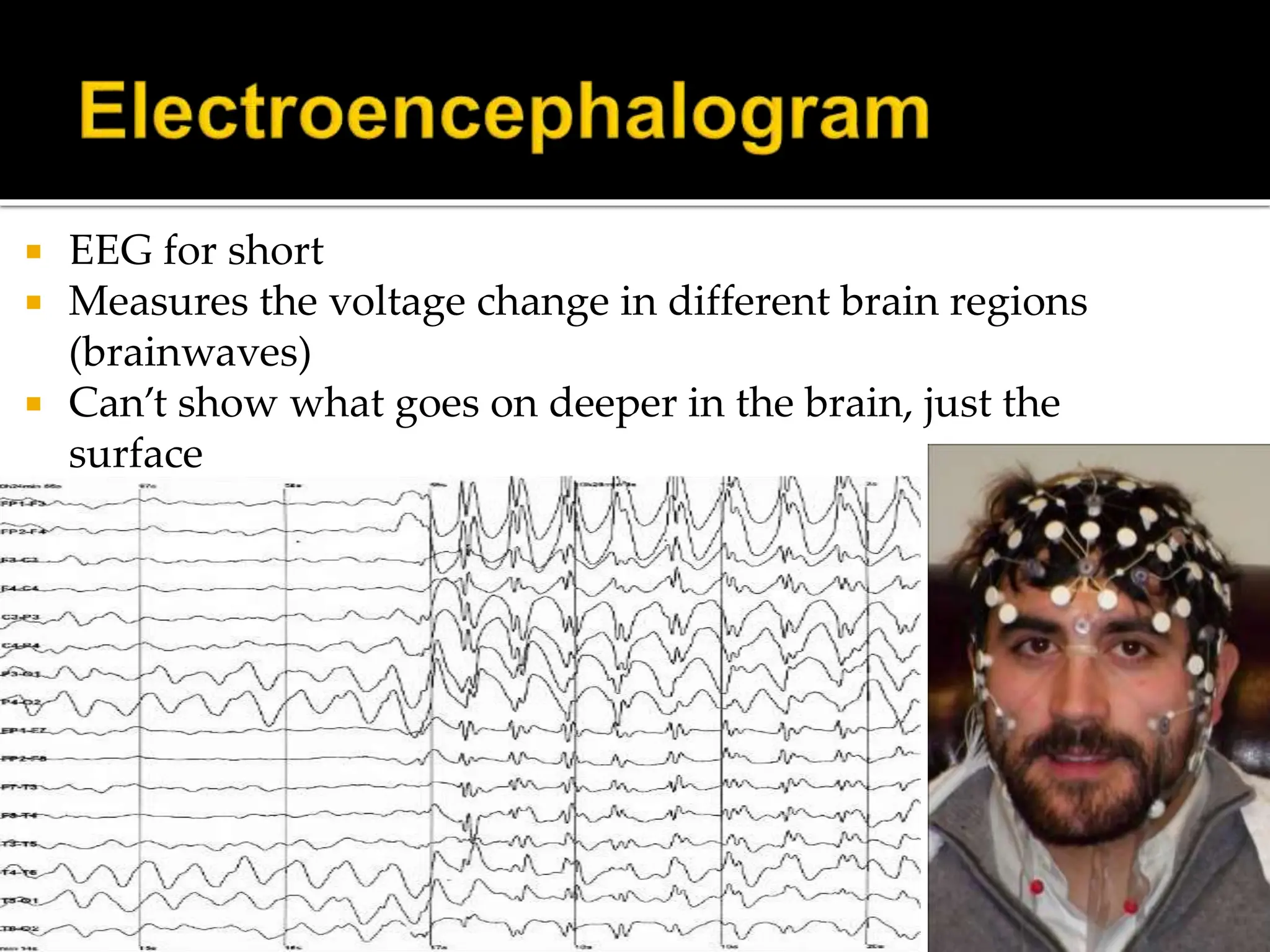 IB Psychology The Biological Level of Analysis.pptx