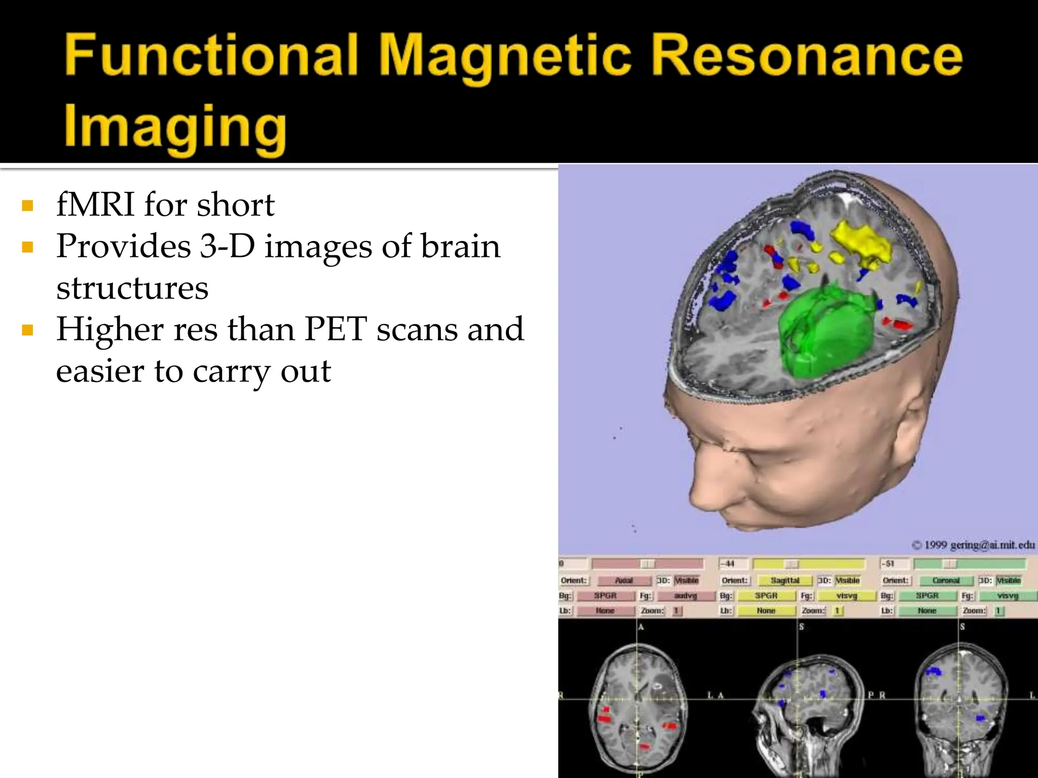 IB Psychology The Biological Level of Analysis.pptx