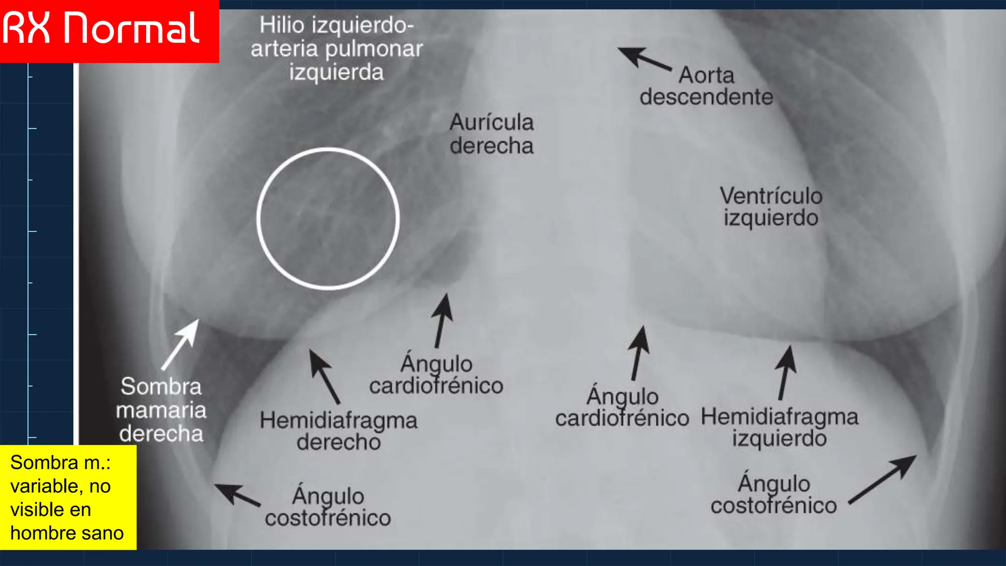 IMAGENOLOGIA DE TORAX EN DIFERENTES PROYECCIOENS | PPTX