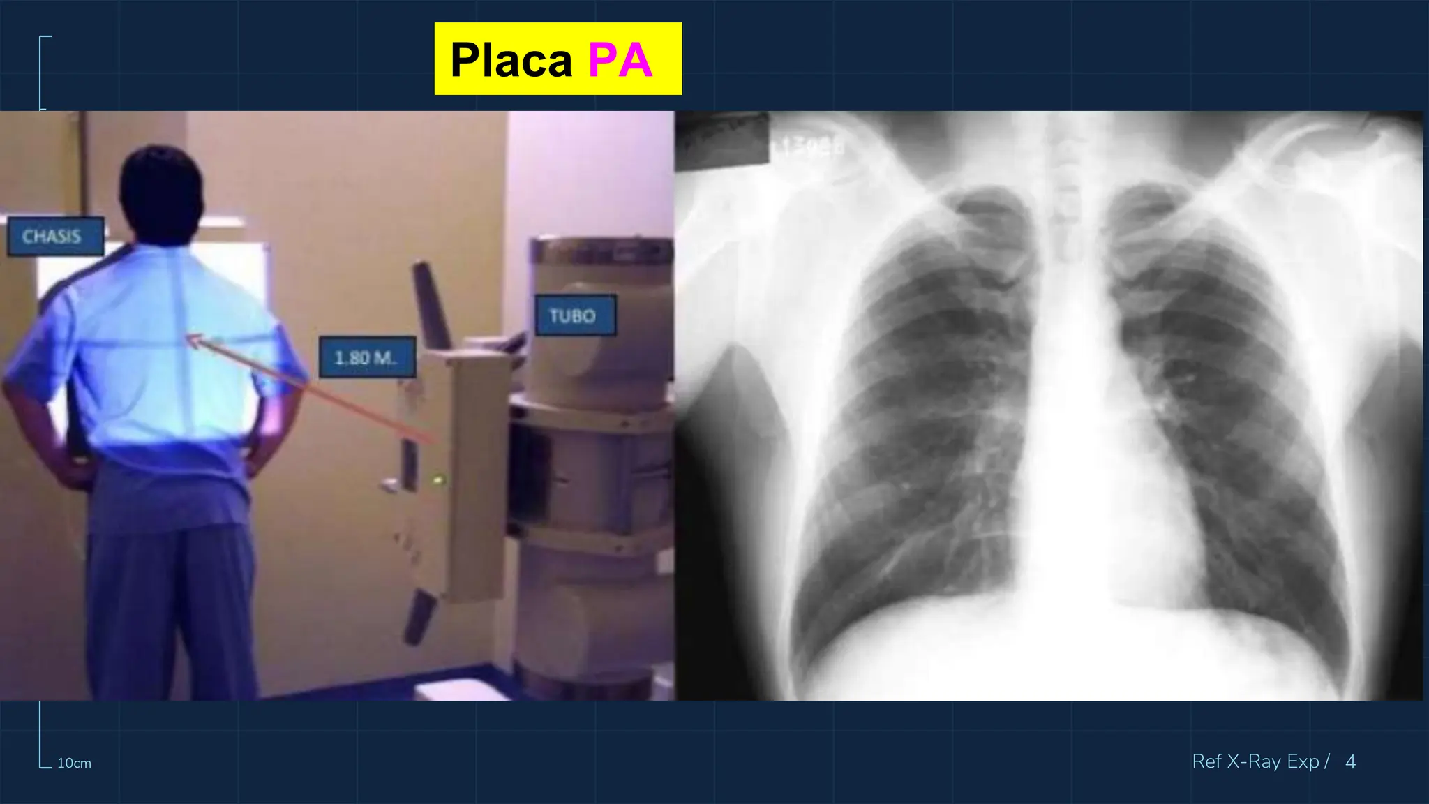 IMAGENOLOGIA DE TORAX EN DIFERENTES PROYECCIOENS | PPTX