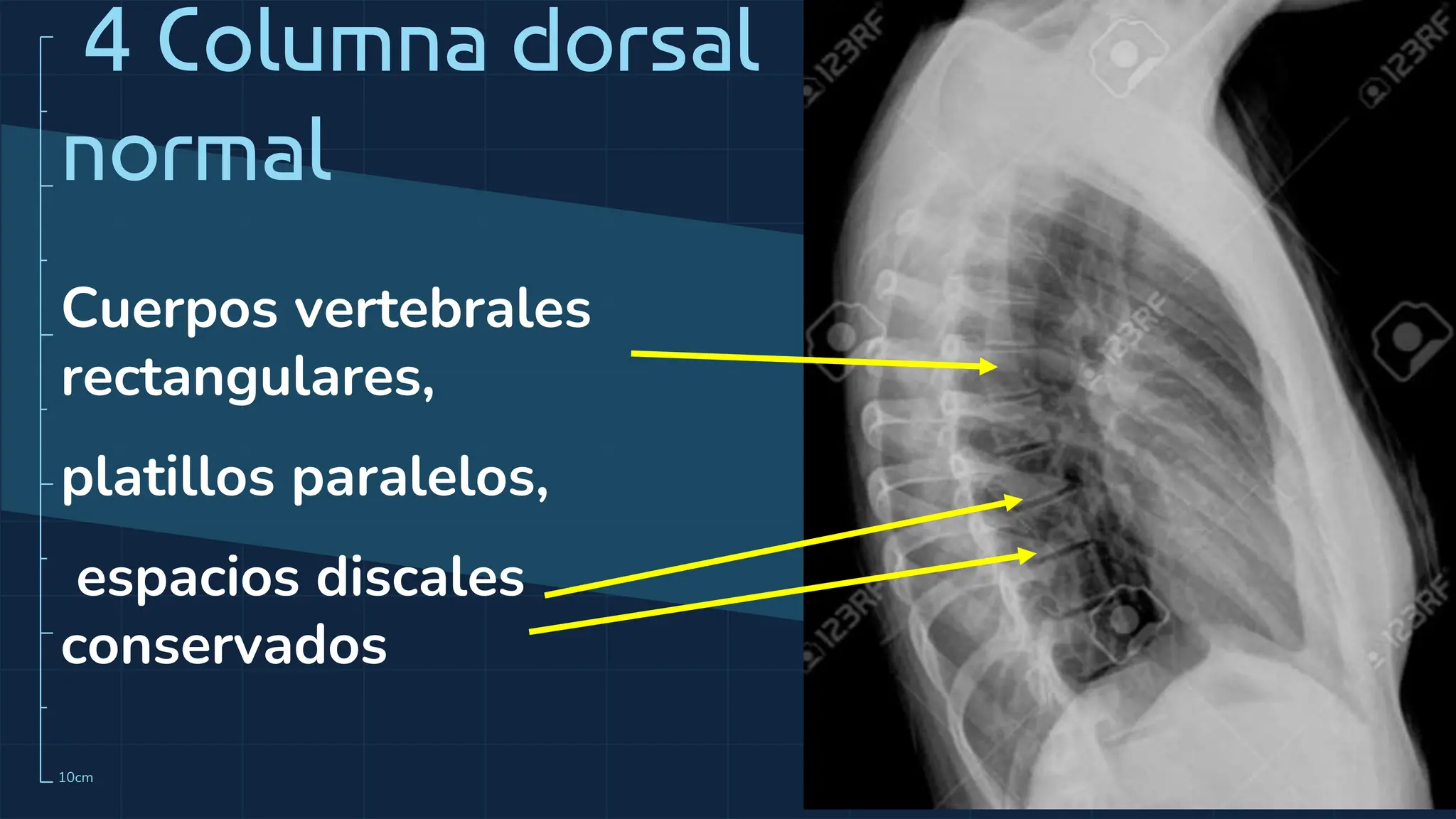 IMAGENOLOGIA DE TORAX EN DIFERENTES PROYECCIOENS | PPTX