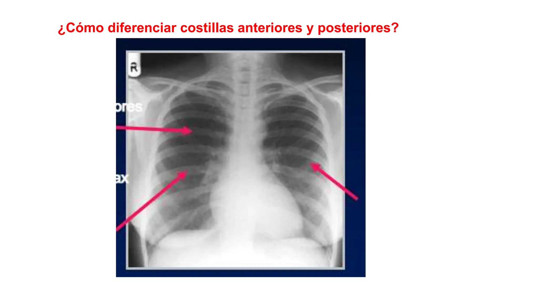 IMAGENOLOGIA DE TORAX EN DIFERENTES PROYECCIOENS | PPTX