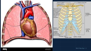 IMAGENOLOGIA DE TORAX EN DIFERENTES PROYECCIOENS | PPTX