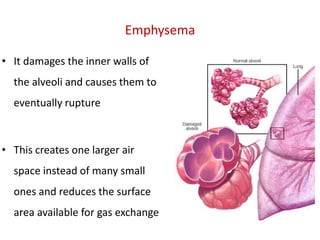 Chronic Obstructive Pulmonary Disease / COPD | PPT