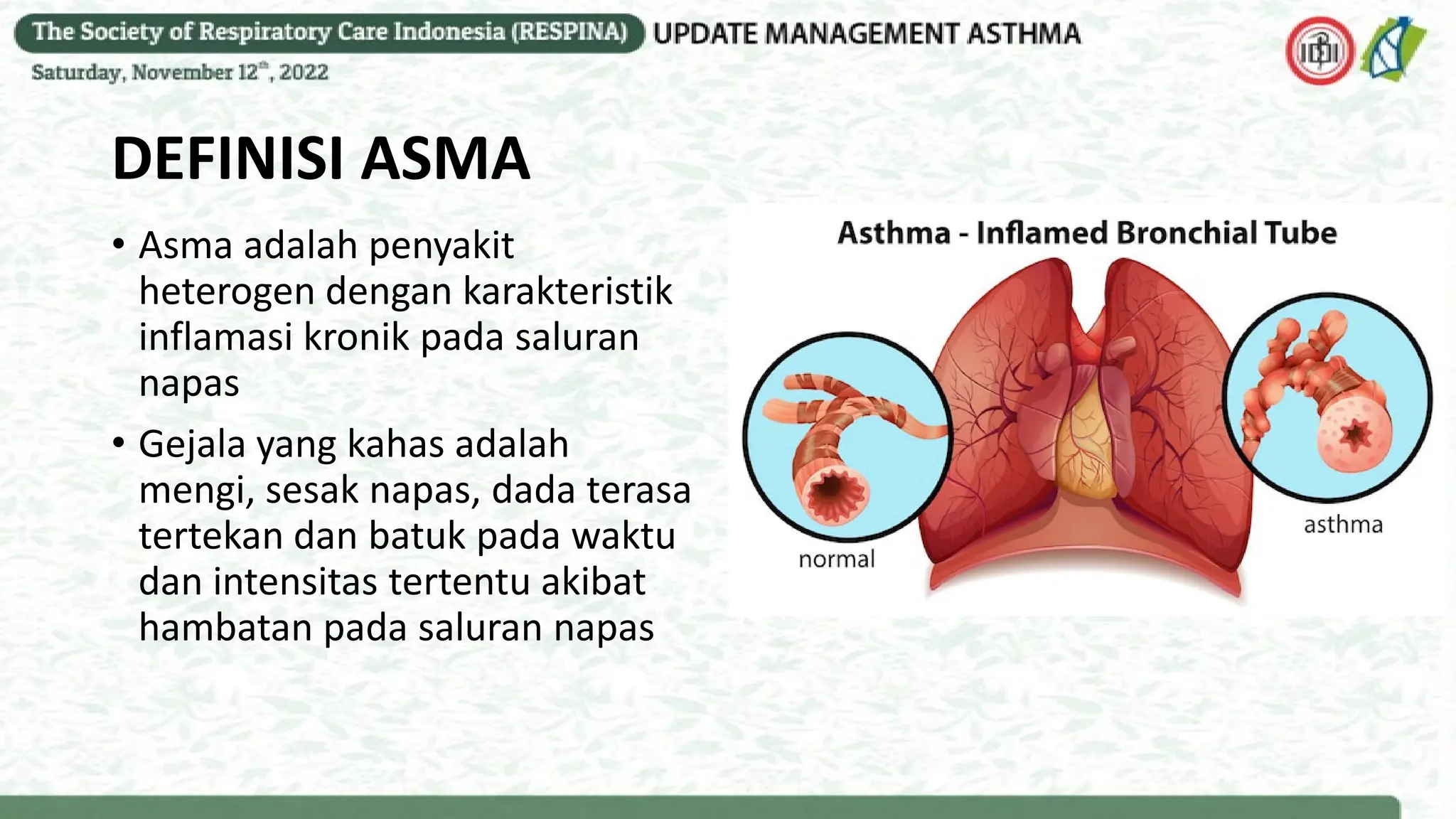 Simpel approach in achebieng asma control with regular dosing | PDF