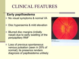 3. PAPILLOEDEMA Neuro Ophthalmology0.ppt