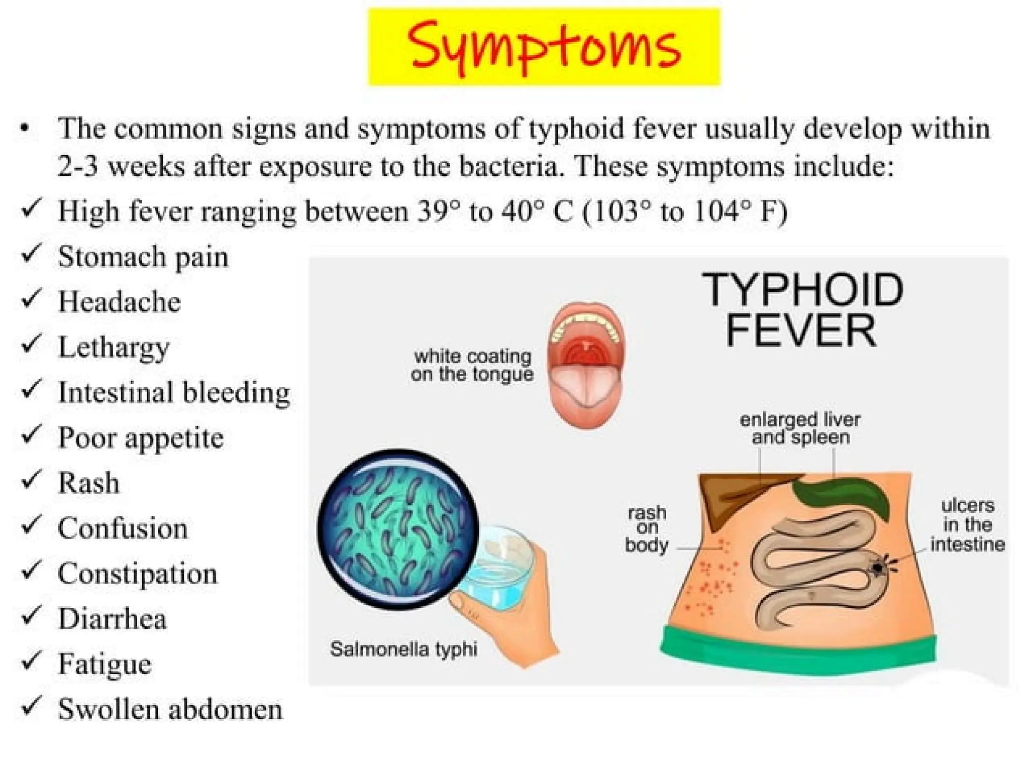 Pathophysiology of Typhoid ,Its clinical manifestation, Treatment. | PDF