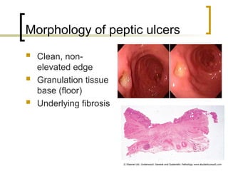 Stomach MBBS Medicine - power point presentation | PPT