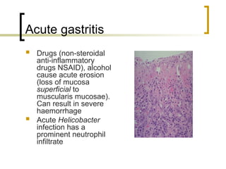 Stomach MBBS Medicine - power point presentation | PPT