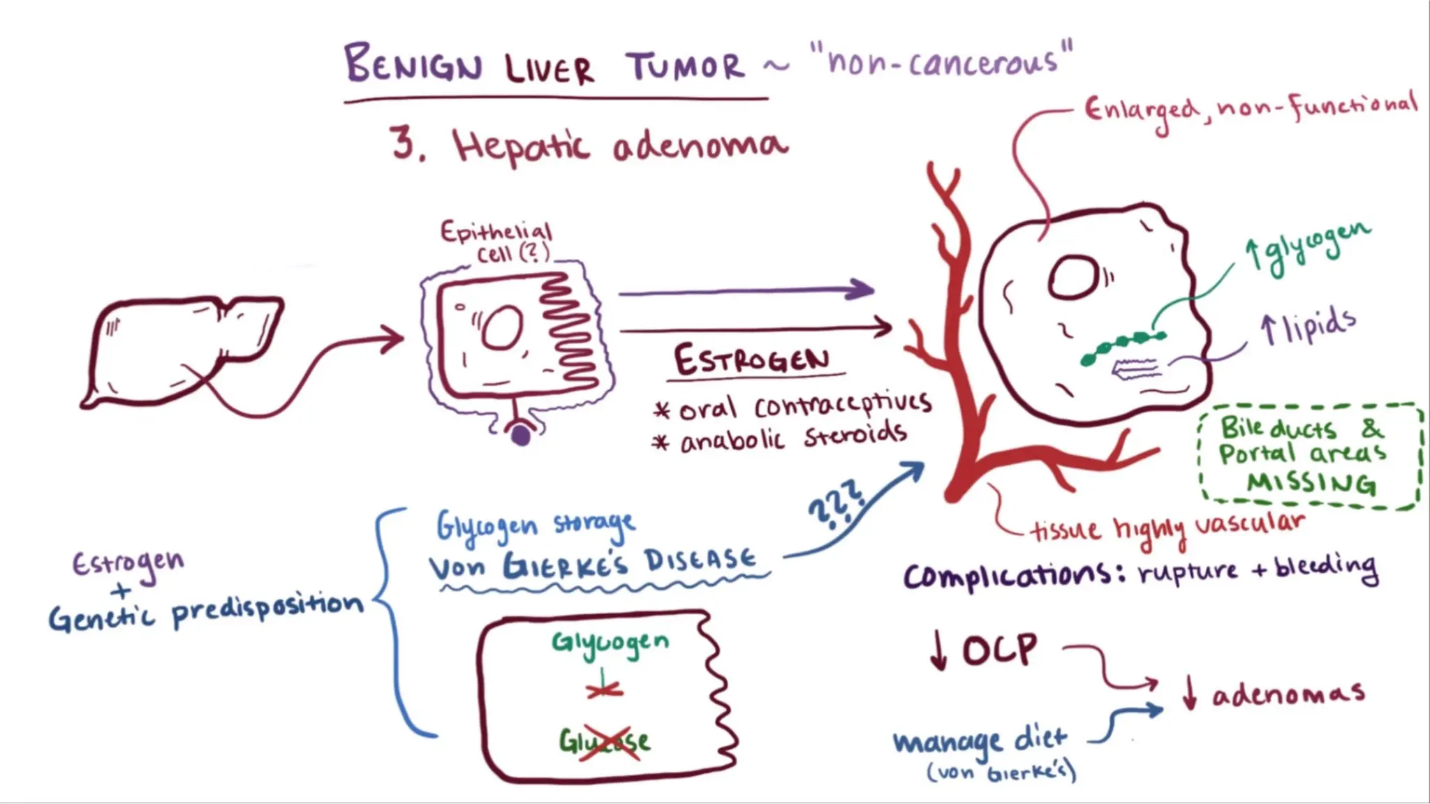 3. Benign liver tumors (General Surgery)=.pptx