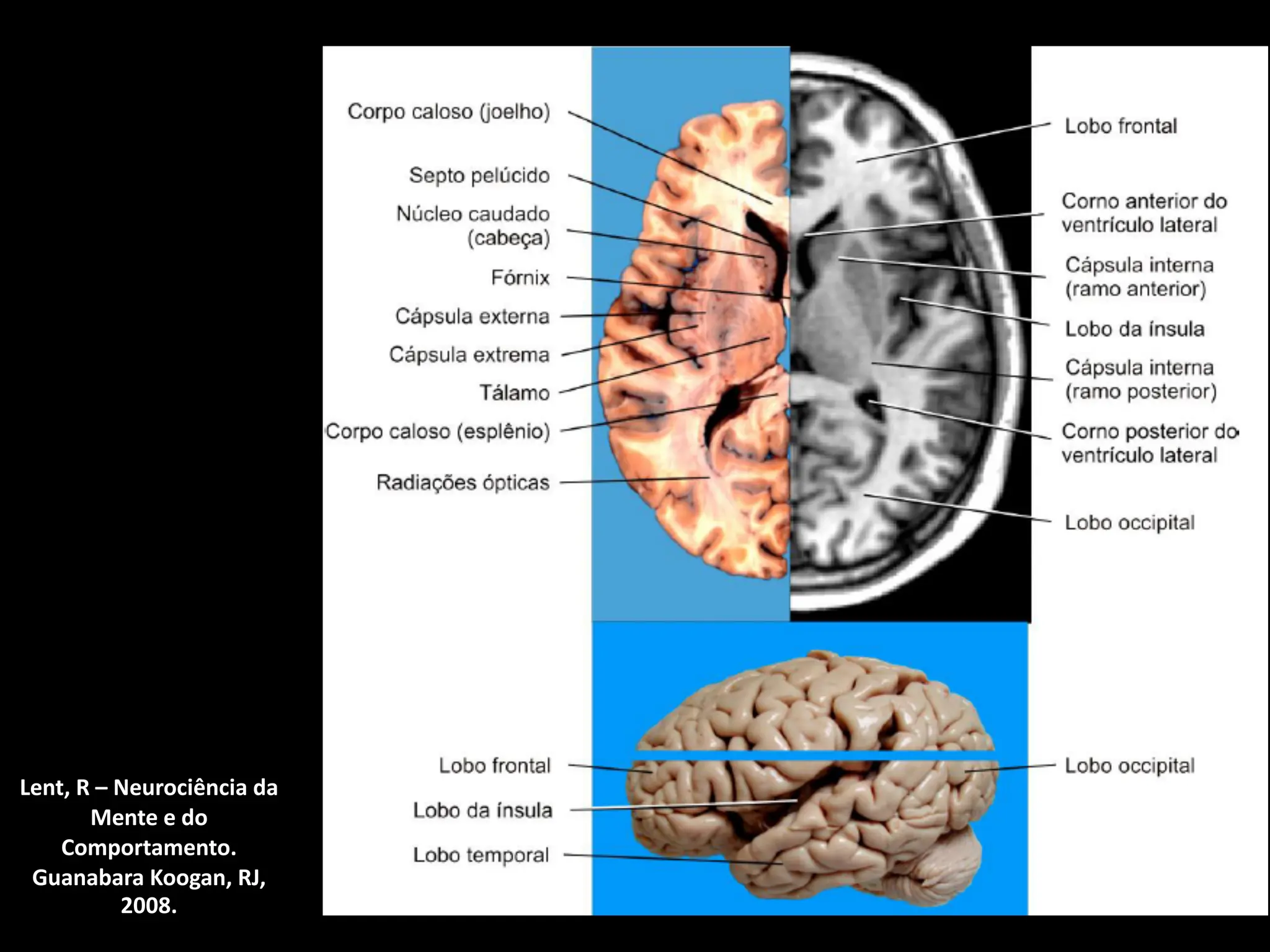 NÚCLEOS DA BASE- ANATOMIA DO CORPO HUMANO | PPT