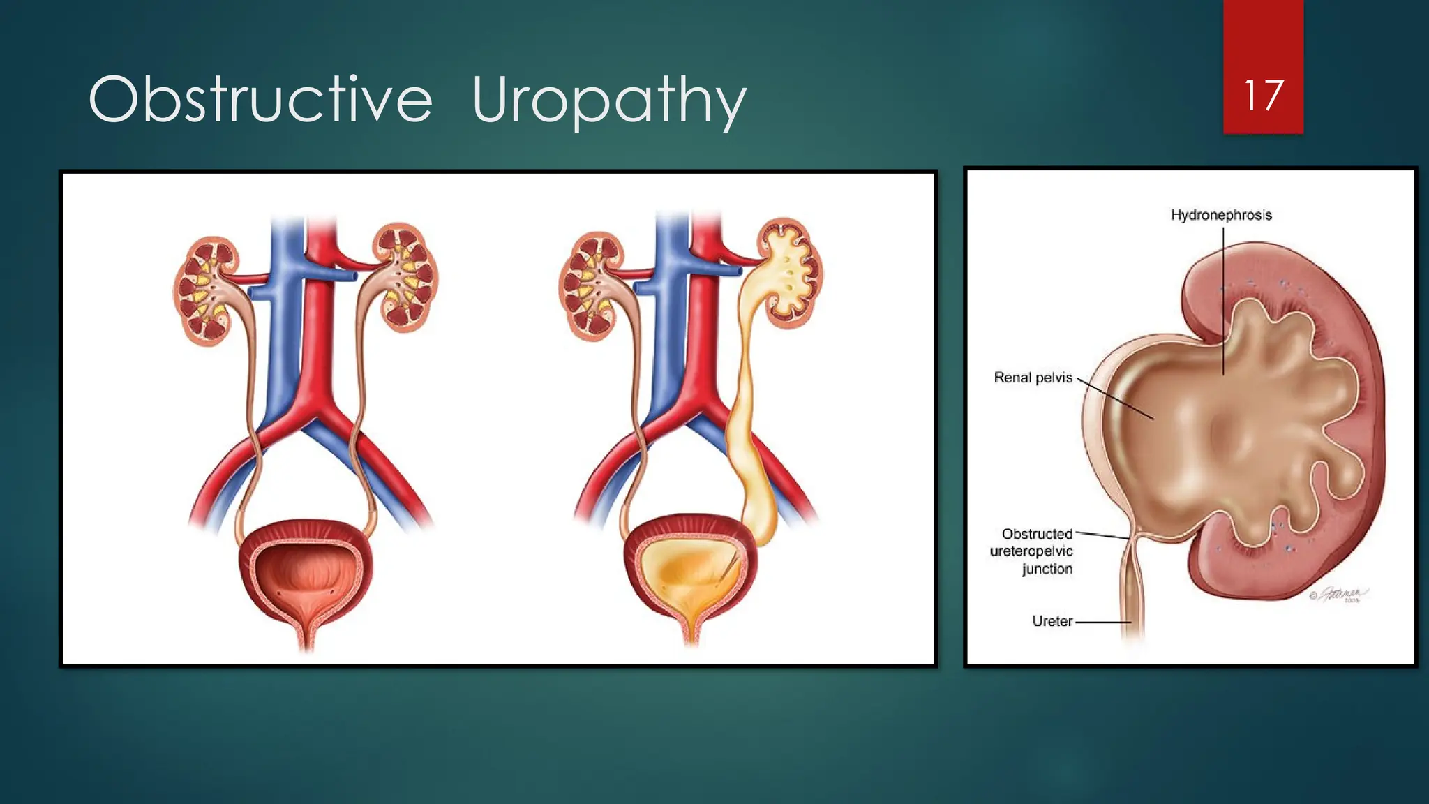 3.URINARY TRACT IMAGING PPT by Ravindra Kumar.pptx