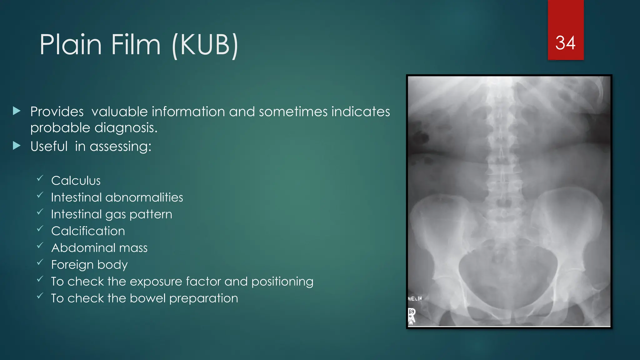 3.URINARY TRACT IMAGING PPT by Ravindra Kumar.pptx