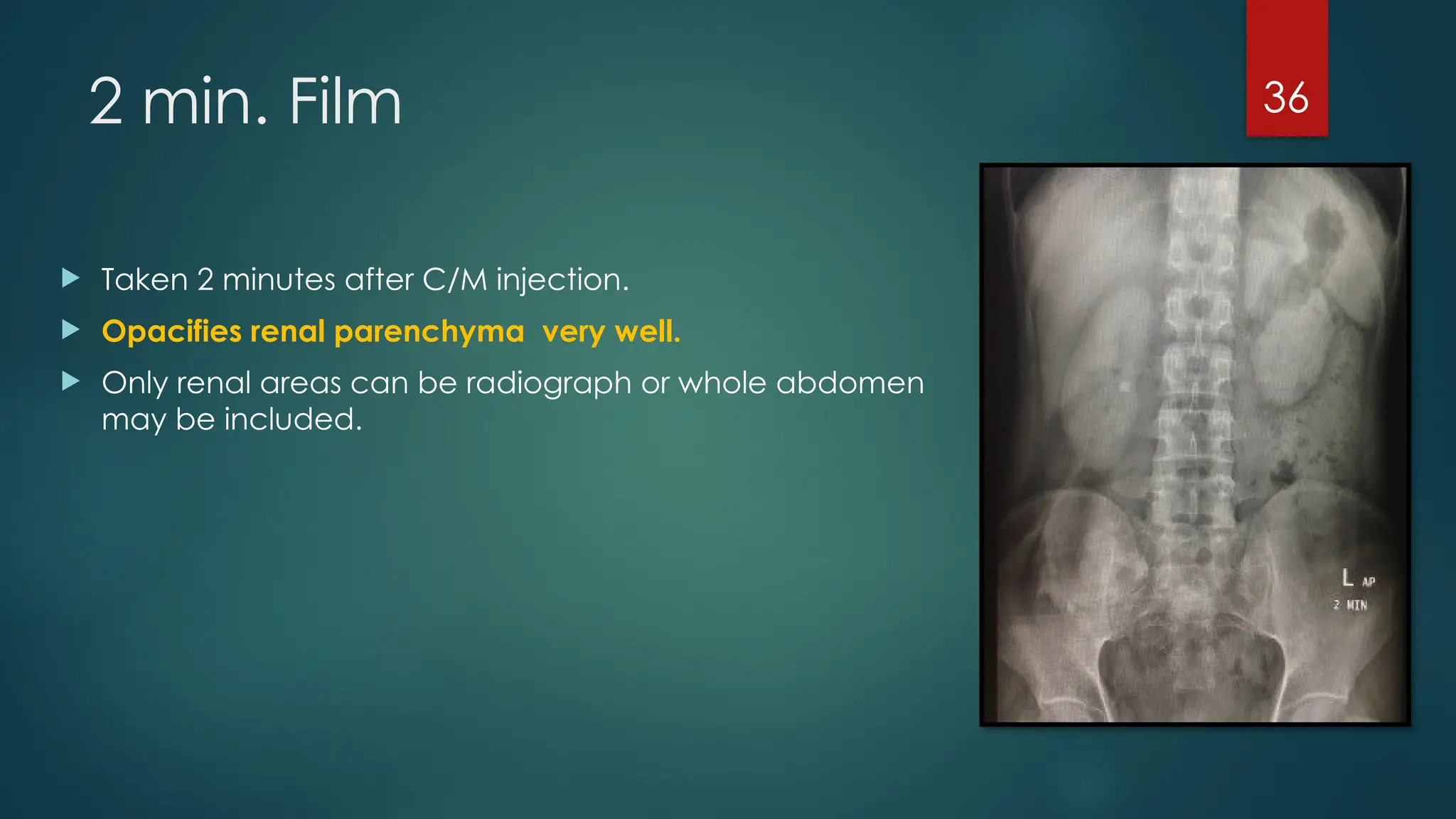 3.URINARY TRACT IMAGING PPT by Ravindra Kumar.pptx