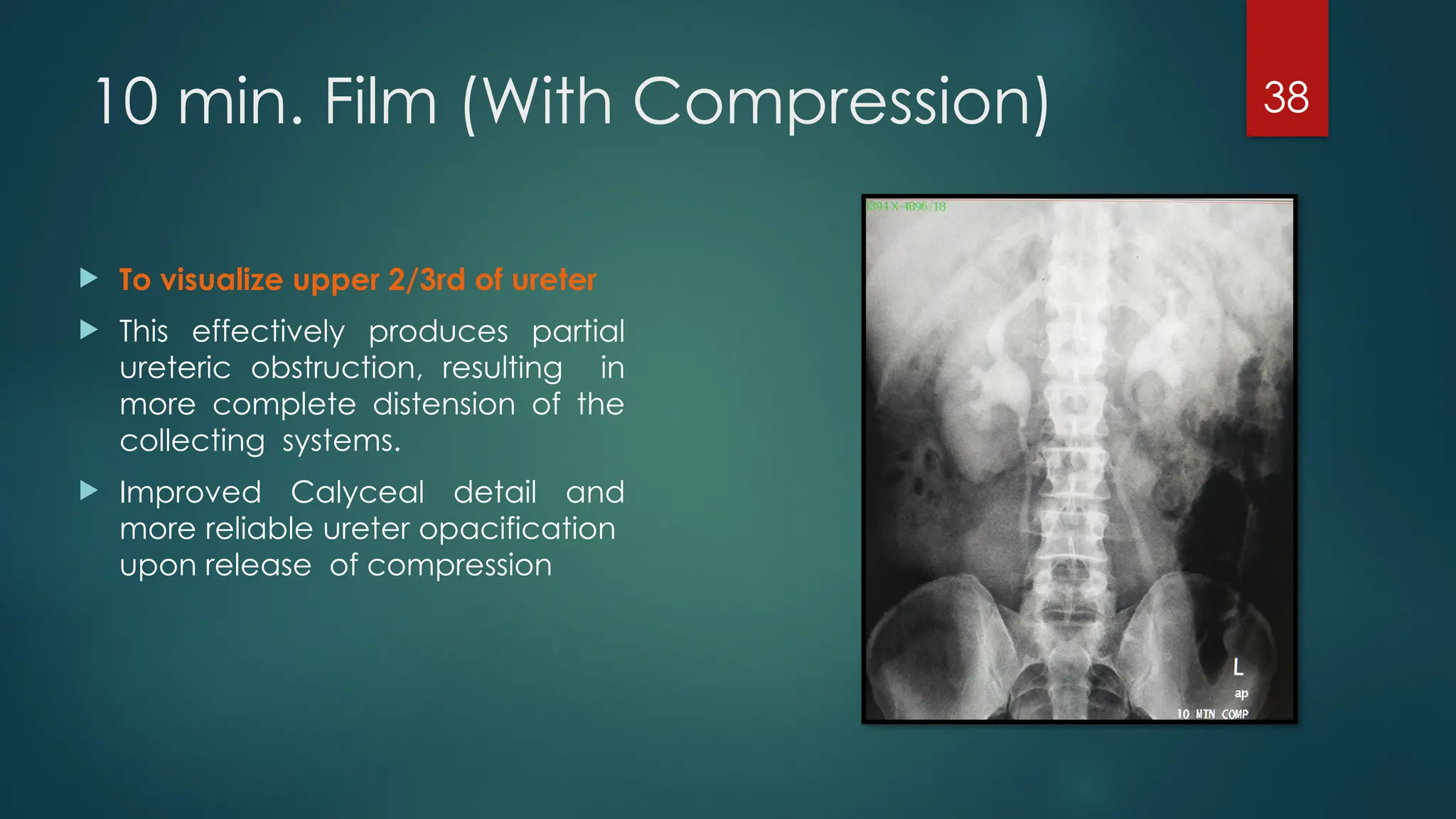 3.URINARY TRACT IMAGING PPT by Ravindra Kumar.pptx
