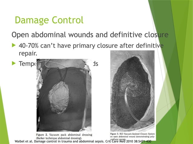 3.abdominal trauma (1).pptx notes | PPT
