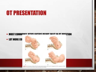 7 CARDINAL MOVEMENTS OF LABOUR.pptx Obgy | PPTX