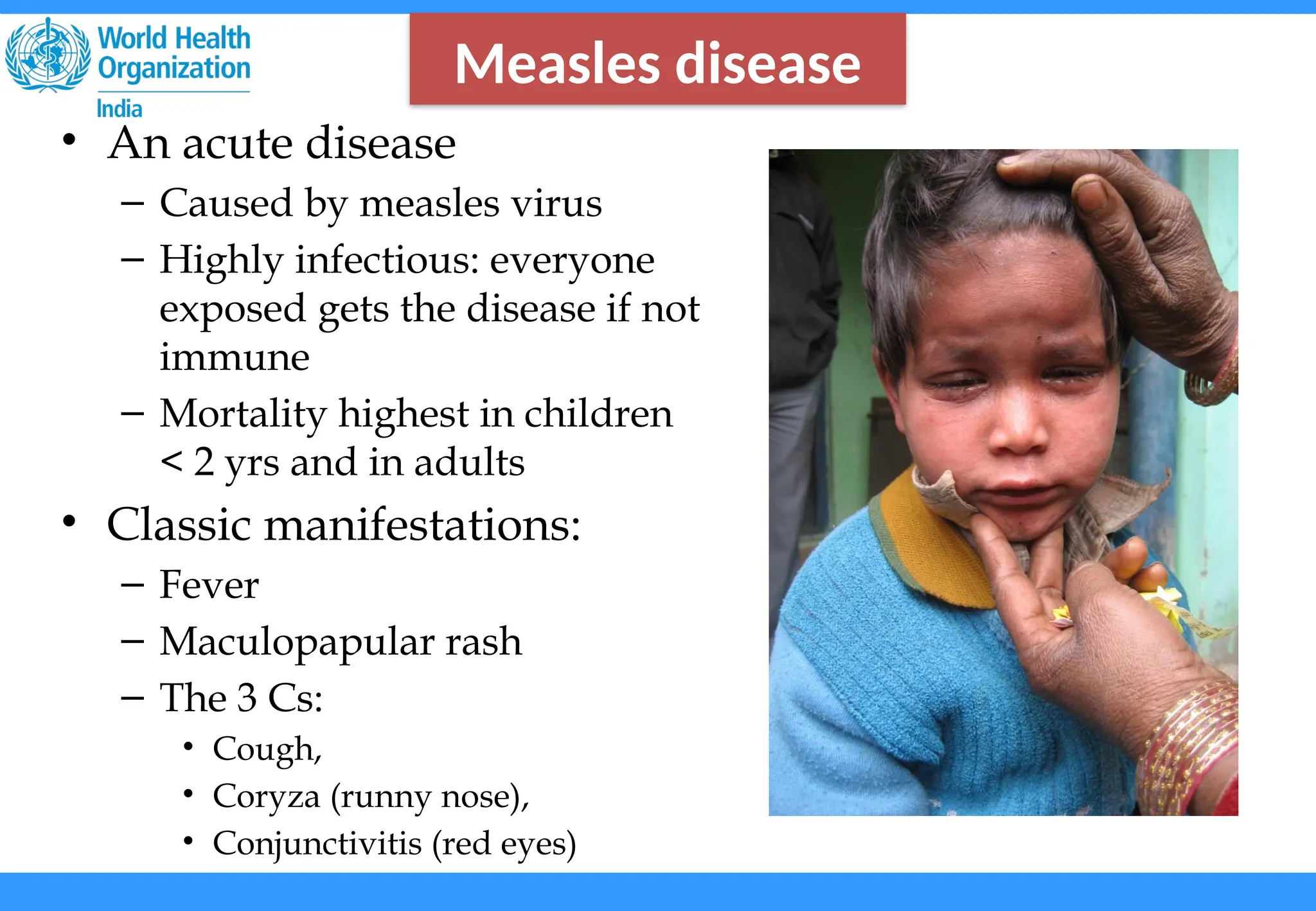 3. Measles Rubella – Differential Diagnoses (2).pptx