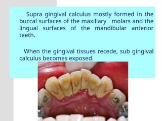 3. Etiology and pathogenesis of periodontal disease.pptx