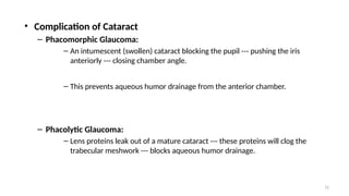 3. Cataract from Gambella University.ppt