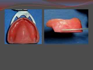 Face bow transfer semi adjustable complete denture | PPTX