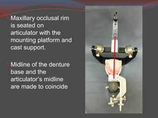 Face bow transfer semi adjustable complete denture | PPTX
