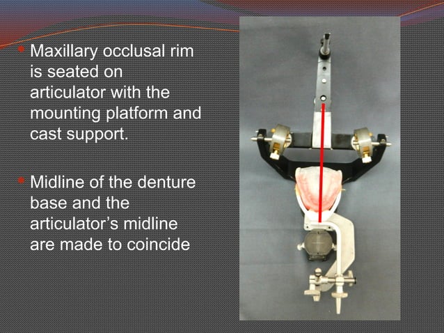 Face bow transfer semi adjustable complete denture | PPTX