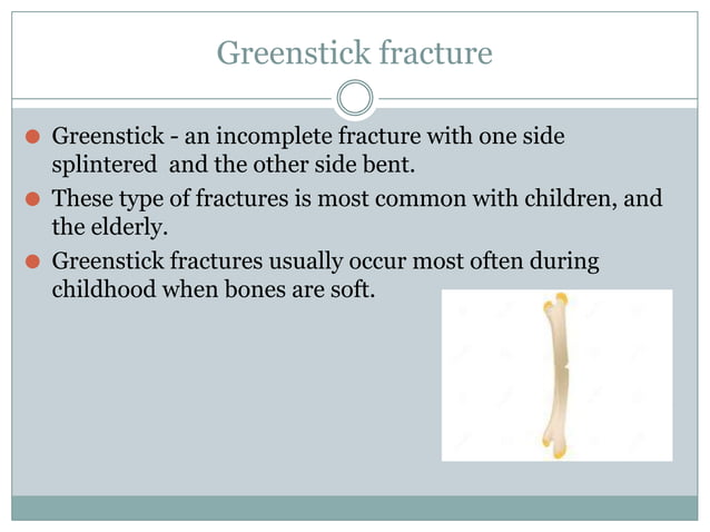 bone fracture and it's types in biomechanics | PPT