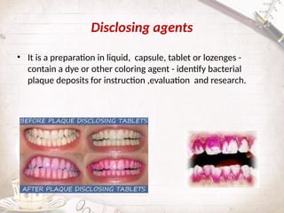 3.plaque control and dental caries and prevention | PPTX