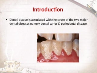 3.plaque control and dental caries and prevention | PPTX