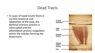 3. etiology/ DENTAL PULP, PULP CHARACTHERISTICS | PPT