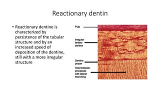 3. etiology/ DENTAL PULP, PULP CHARACTHERISTICS | PPT