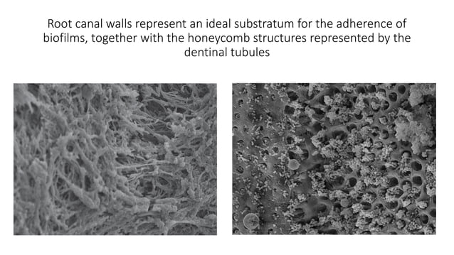 3. etiology/ DENTAL PULP, PULP CHARACTHERISTICS | PPT
