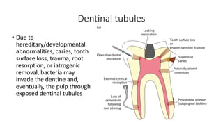 3. etiology/ DENTAL PULP, PULP CHARACTHERISTICS | PPT