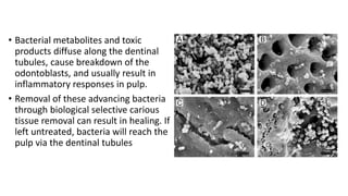3. etiology/ DENTAL PULP, PULP CHARACTHERISTICS | PPT