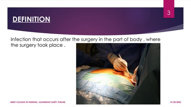 3. PREVENTION OF SSI and nursing management .pptx