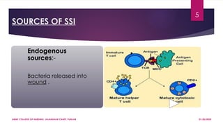 3. PREVENTION OF SSI and nursing management .pptx