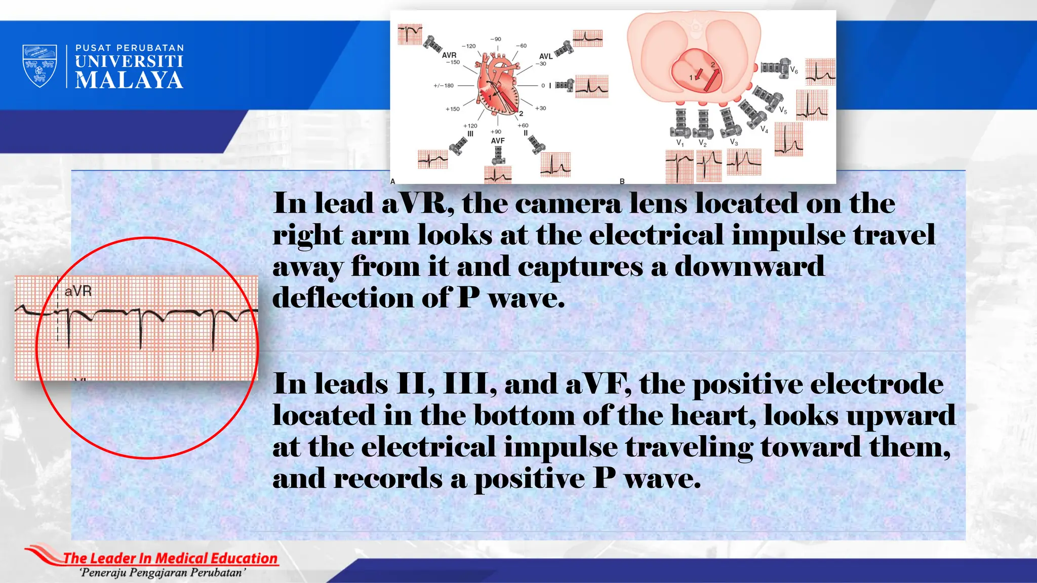 12 LEAD ECG INTERPRETATION nursing in critical care | PPT